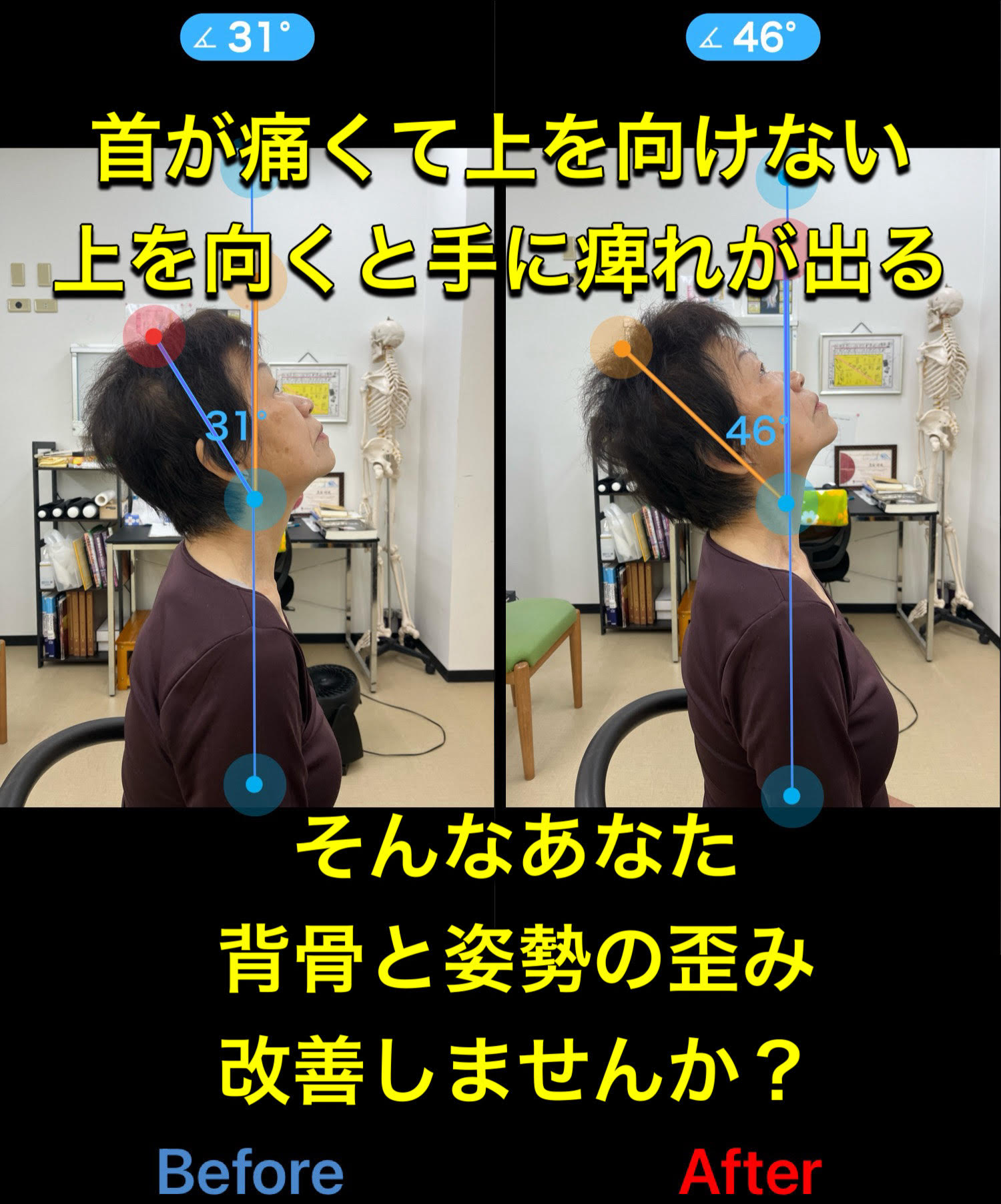 【首が痛くて上を向けない、上を向くと手に痺れが出る そんなあなた背骨と姿勢の歪み改善しませんか？】 ｜ 和歌山市で整骨院選びにお悩みなら腰痛や